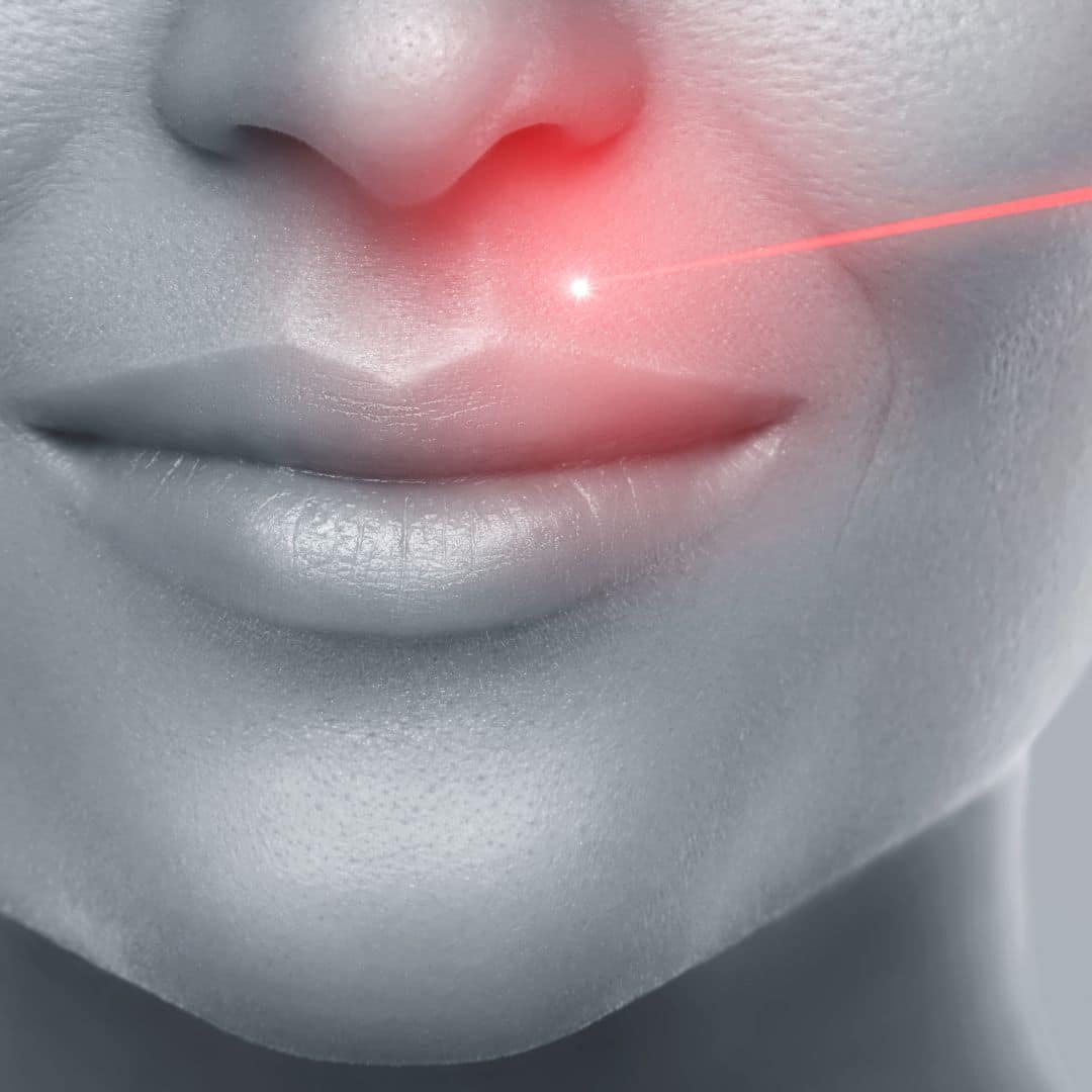 Laserbehandeling ontharen hoe werkt het? | Laserstudionoord.nl